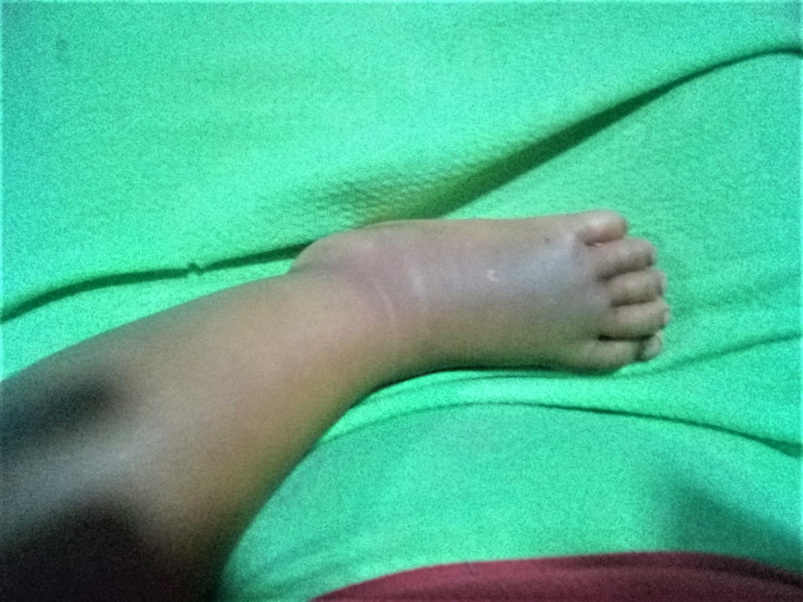 El pequeño Moisés, de tan solo un año, sobrevivió a la mordedura de una ...